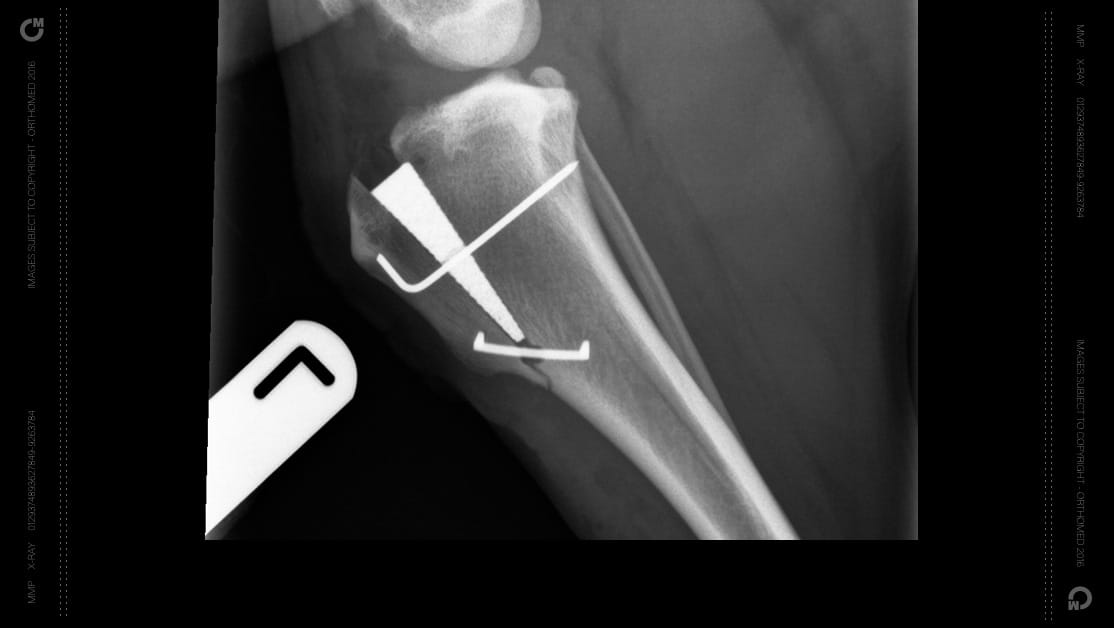 MMP OrthoFoam™ | Canine Cruciate Repair System | Orthomed