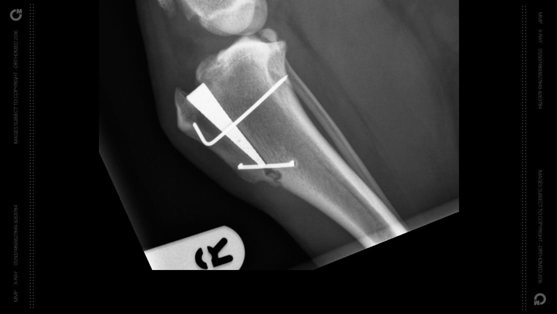 MMP OrthoFoam™ | Canine Cruciate Repair System | Orthomed