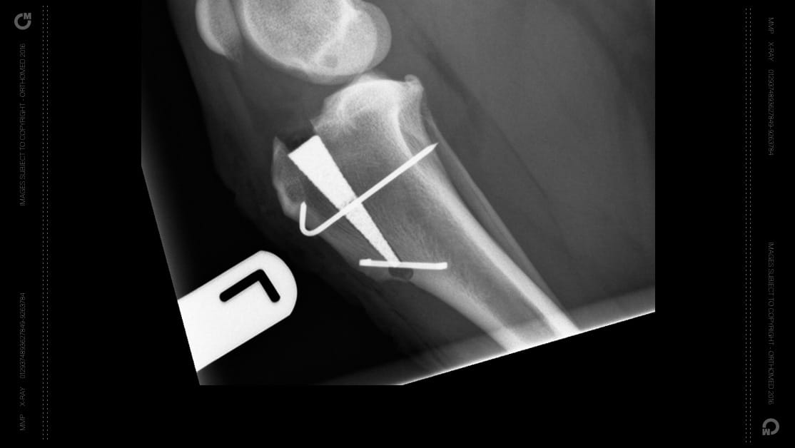 MMP OrthoFoam™ | Canine Cruciate Repair System | Orthomed